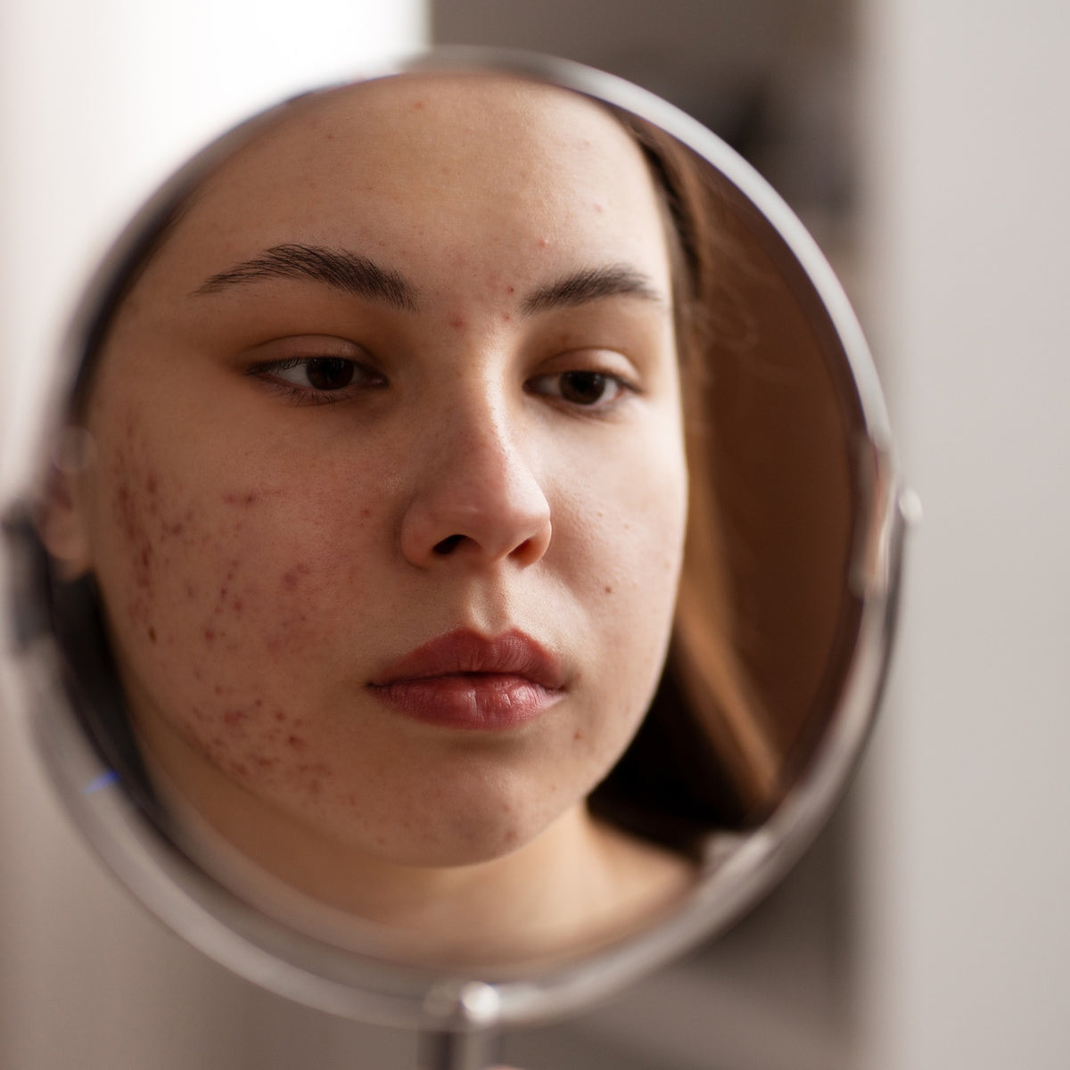 9 Ways To Treat Acne Using Coffee Grounds For Each Skin Type: Normal ...